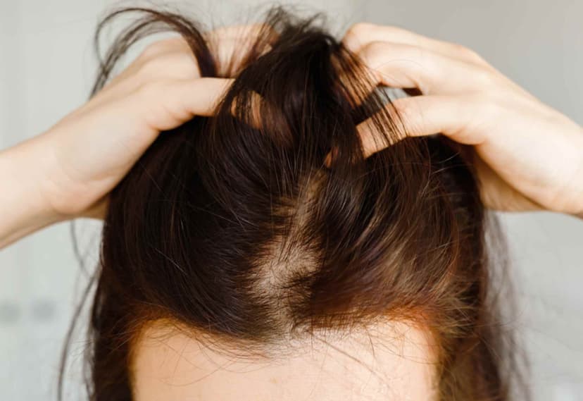 How To Regrow Hair And Reduce Visible Scalp